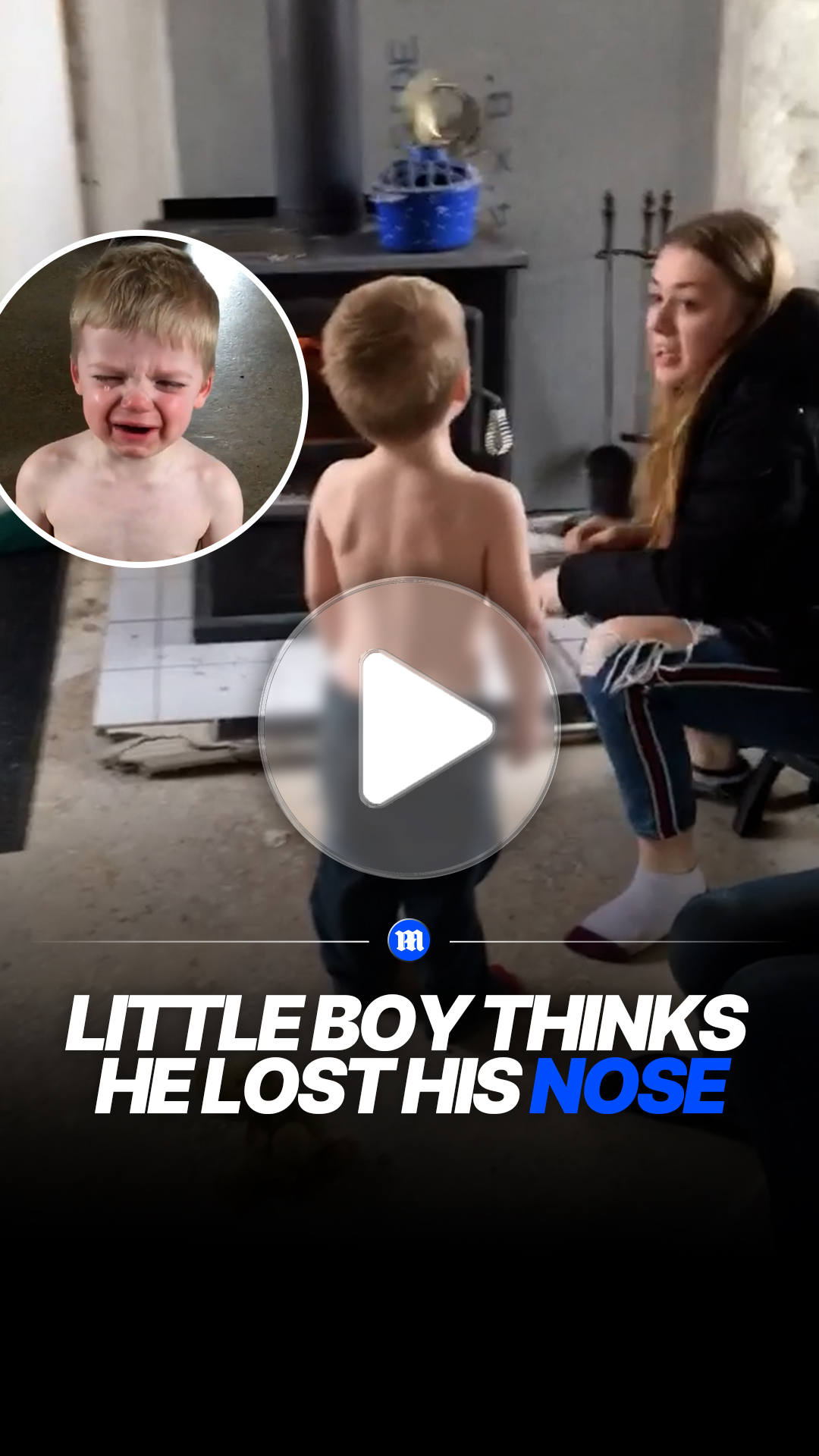 Little boy briefly thinks he lost his nose