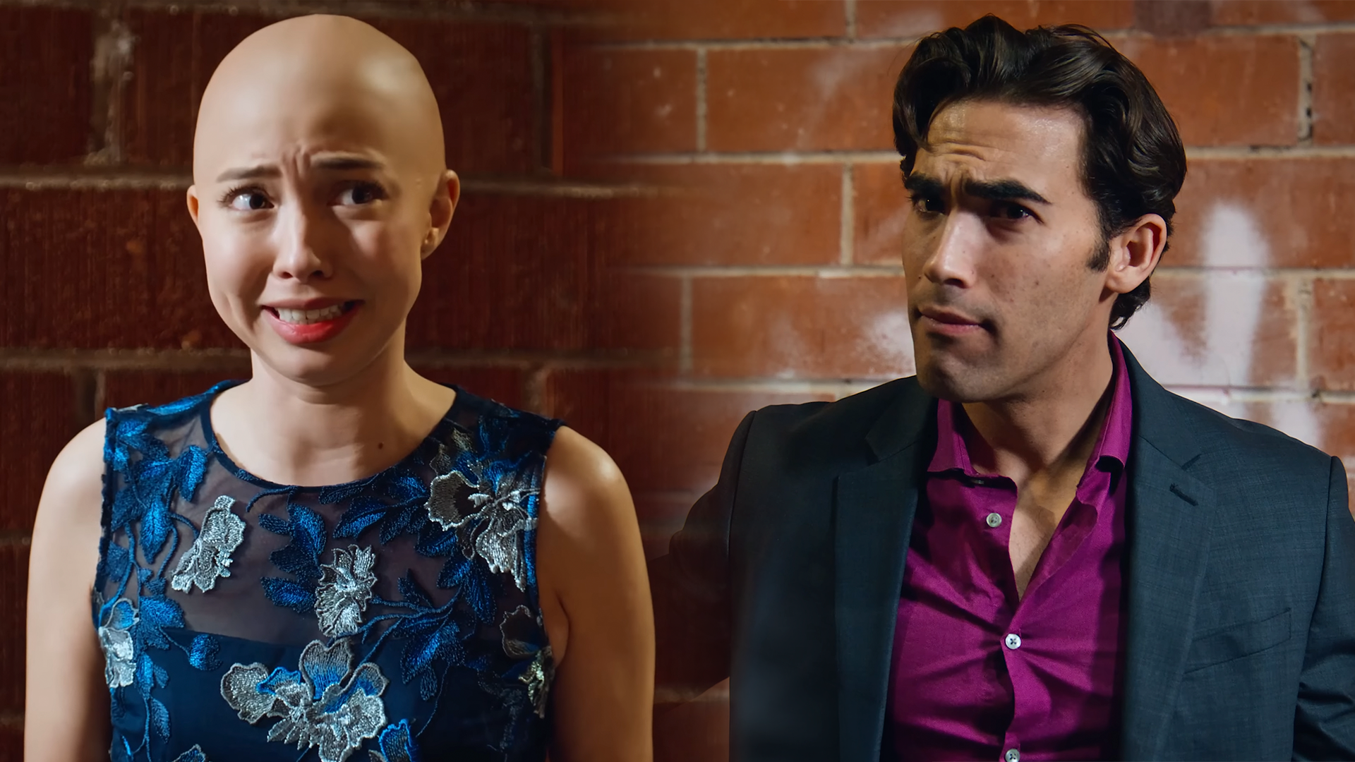 Boyfriend dumps girlfriend over her hair loss