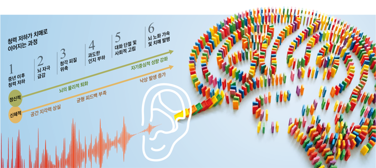 Hearing loss neglect: Silent domino toward dementia
