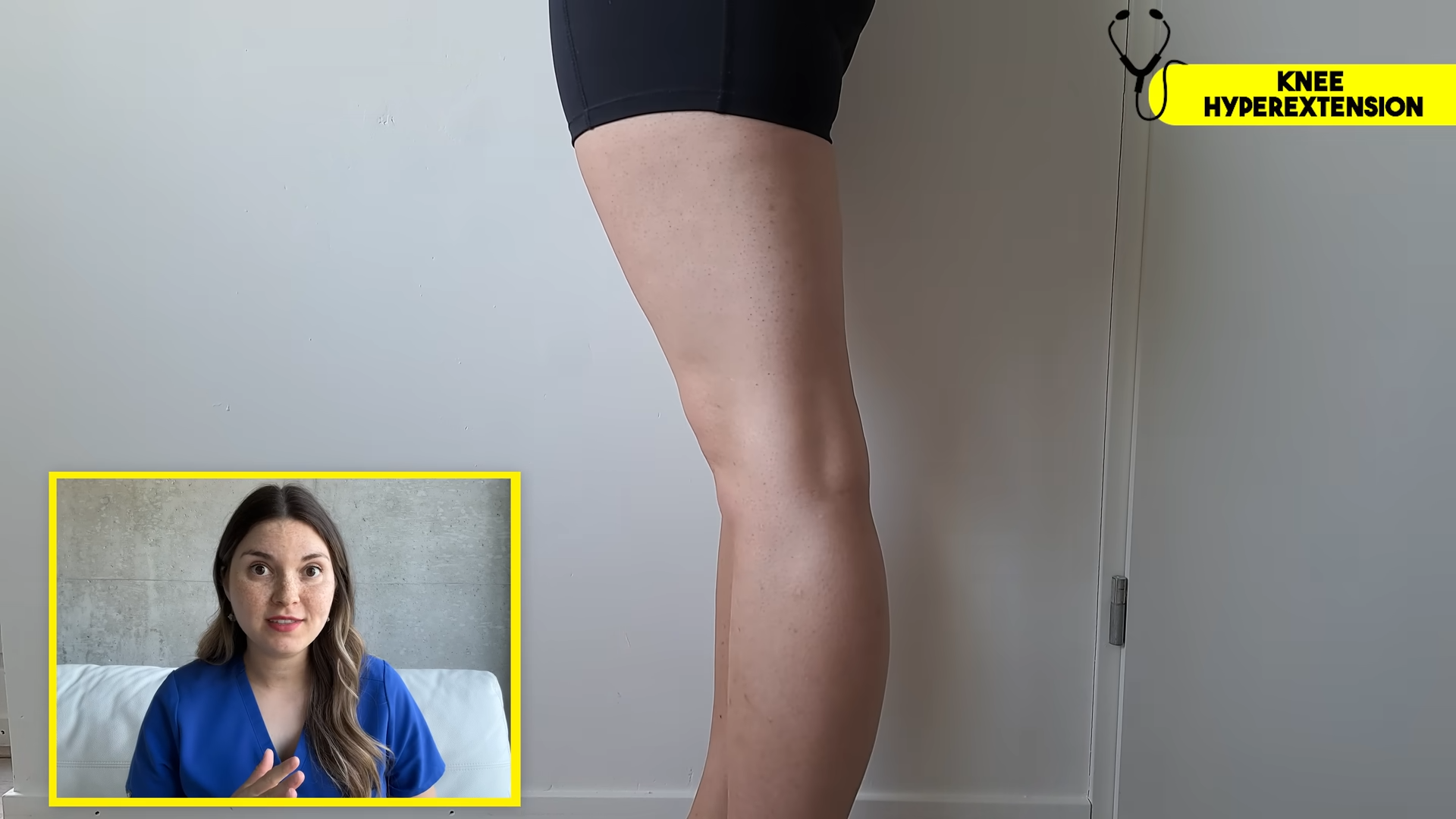 Doctors can spot serious diseases just by looking at your knees