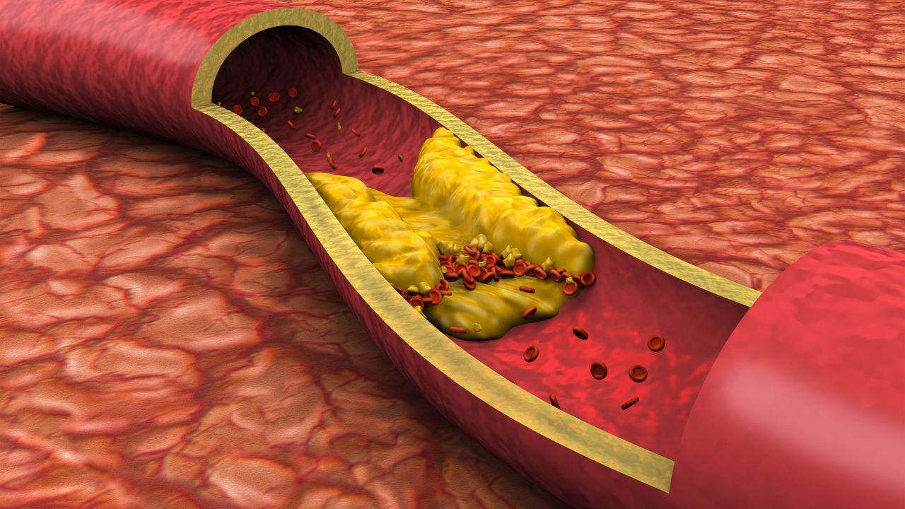 You have heard of 'good' and 'bad' cholesterol: But what if that's not ...