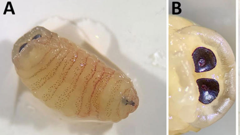 Woman's 'biologically implausible' infection led her to sneeze 'worms ...