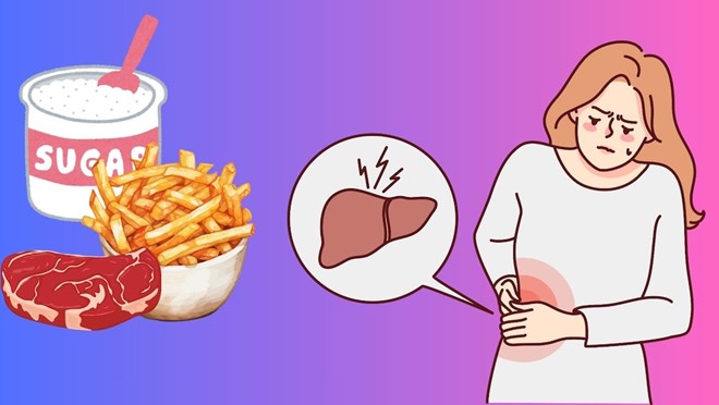Những thực phẩm âm thầm làm gan nhiễm mỡ nặng hơn