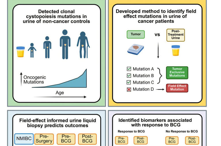 A urine test that could change the course of bladder cancer care