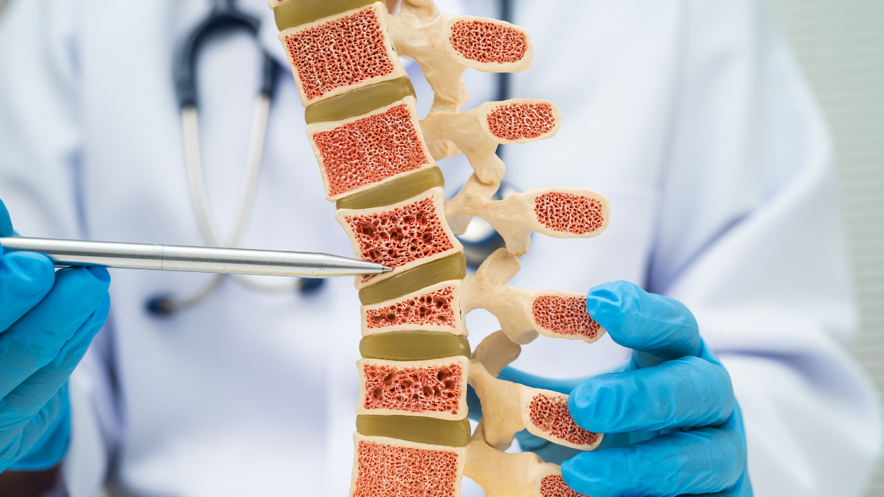 Taking calcium but still have weak bones? Why supplements alone don’t ...