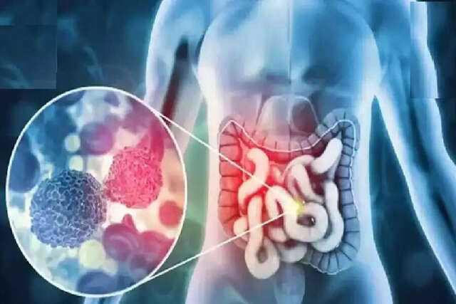 Understanding early signs of cancer: What you need to know