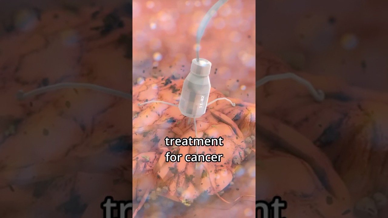 Cancer fighting microbots?