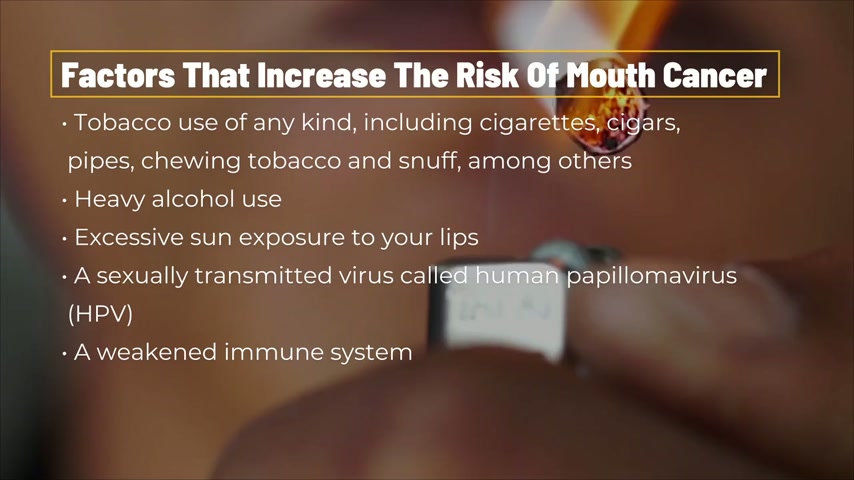 The signs and symptoms of mouth cancer