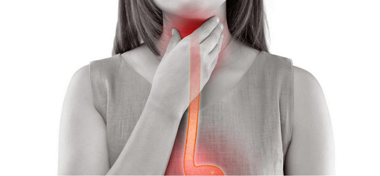 Confirmed precursor to commonest form of esophageal cancer offers ...