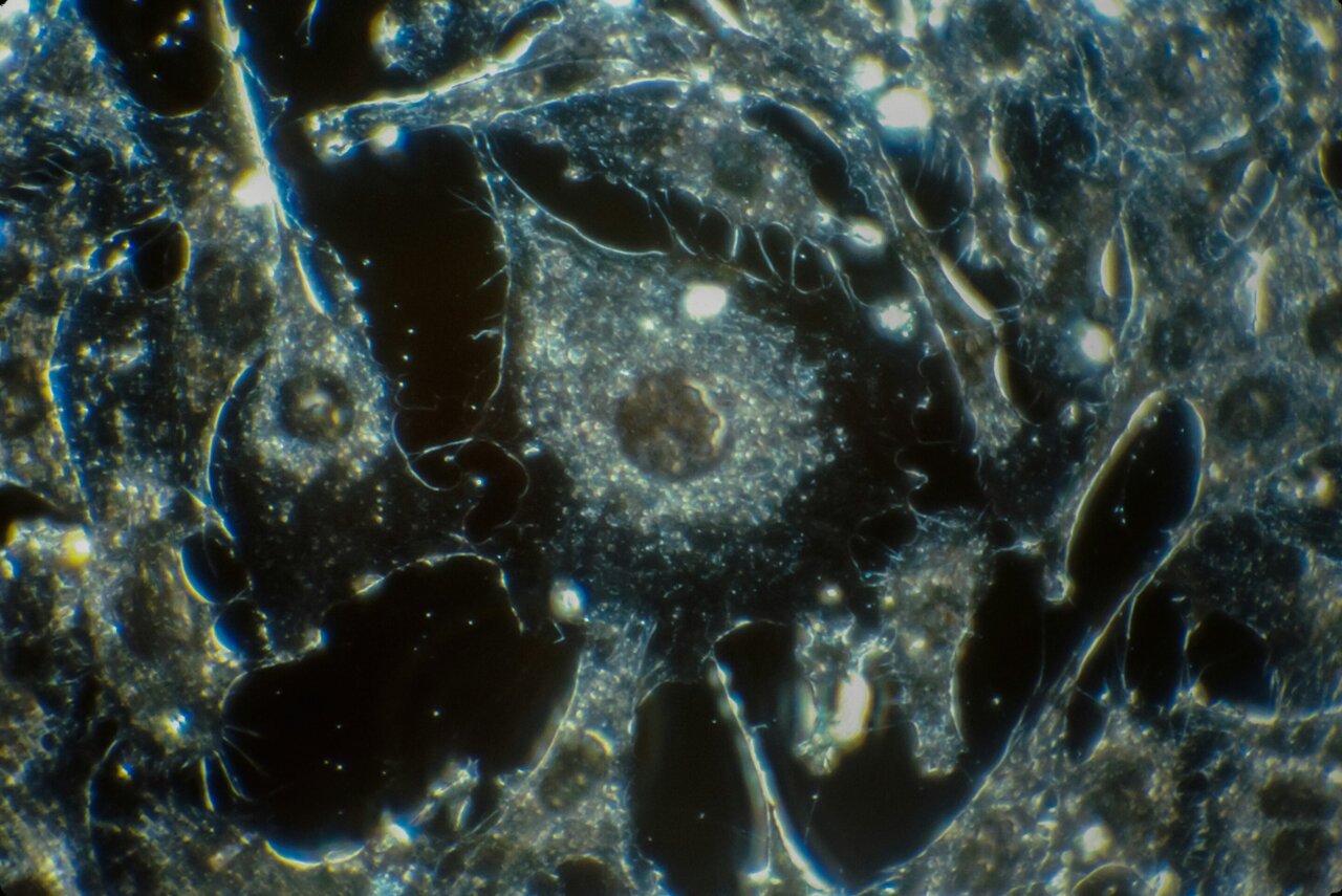 Comprehensive atlas maps dendritic cells across cancers