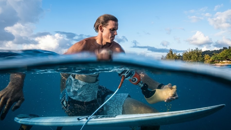 He lost a leg to a 15-foot tiger shark - then faced one again in open water