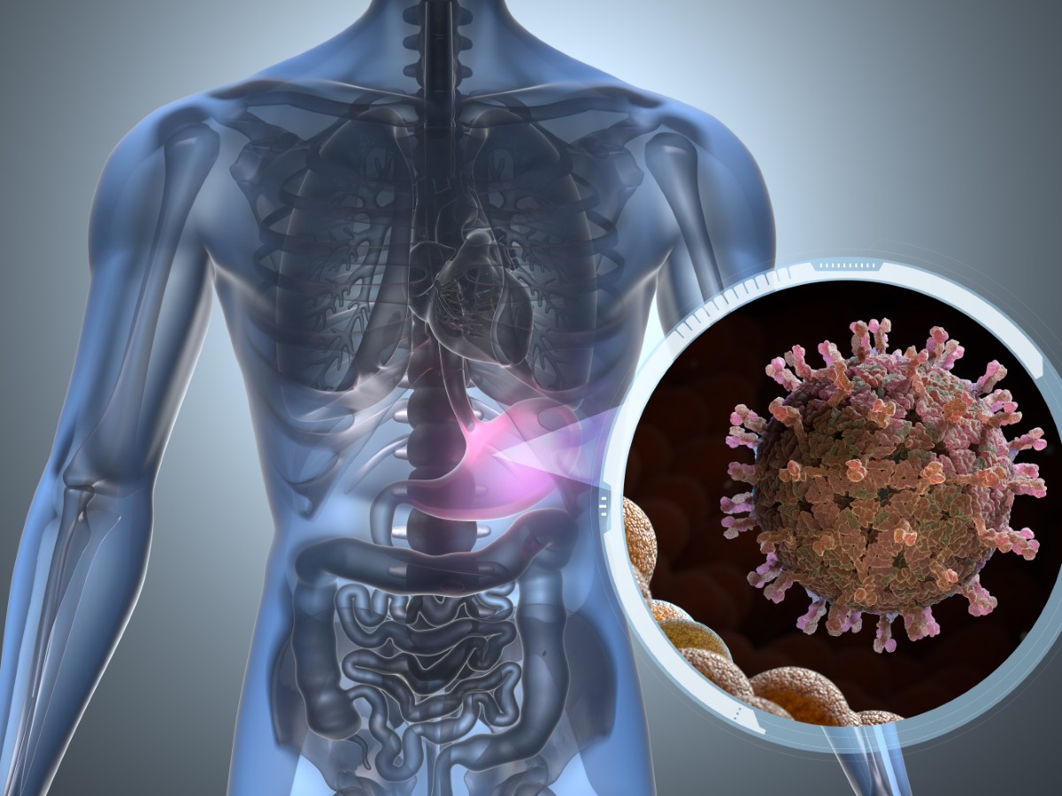 Rotavirus spreads across US - what are symptoms?