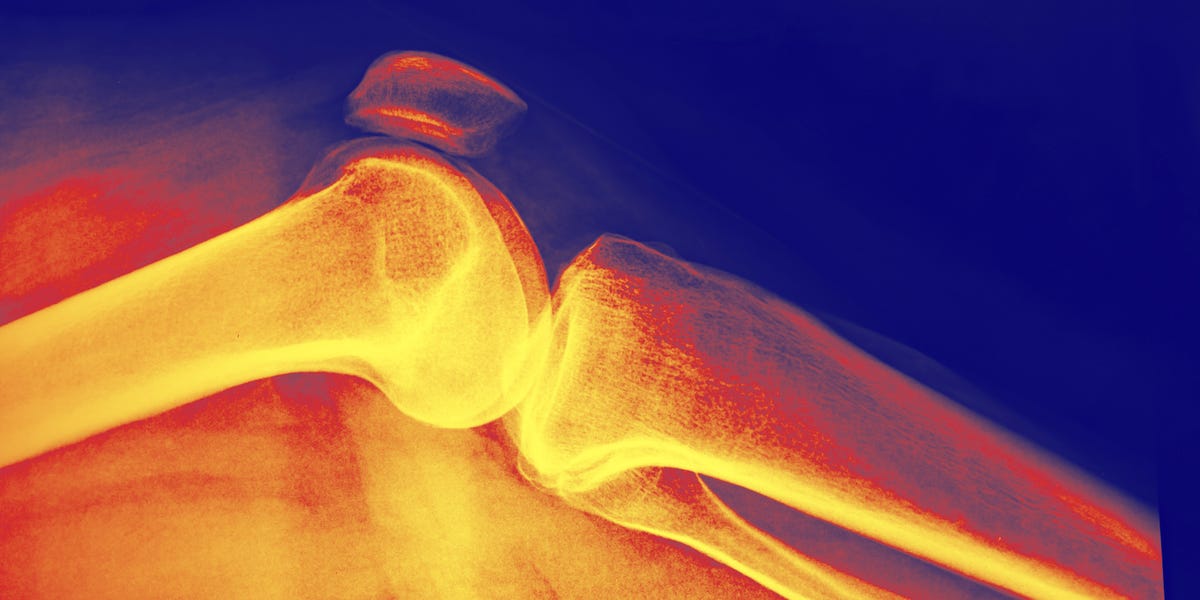 This is exactly how long it takes to increase your bone density ...