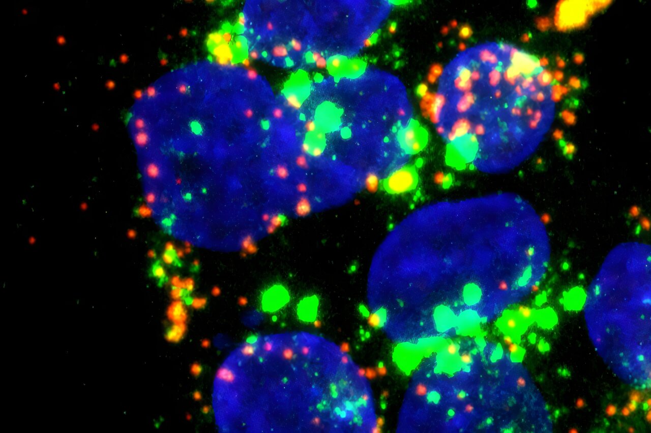 New cellular target prevents hepatitis E infection