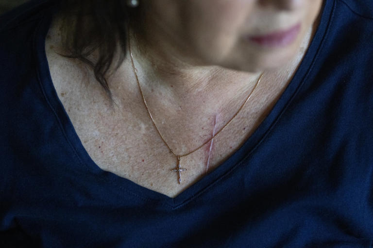 A breakthrough heart procedure comes with risky tradeoffs