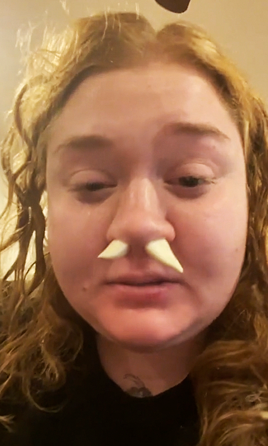 Rise of dangerous garlic TikTok trend ☠️