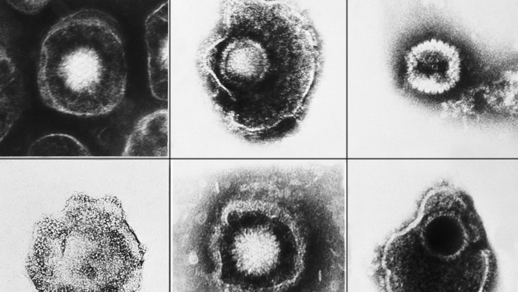 Ancient DNA study maps 10,000 years of human evolution