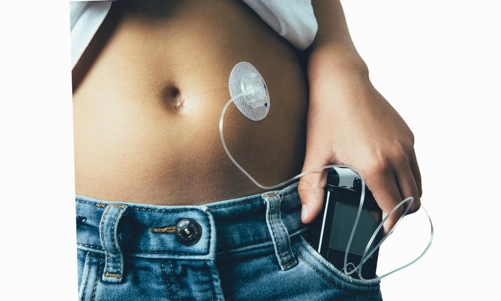 FDA flags high-risk recall for Tandem Diabetes Mobi pumps