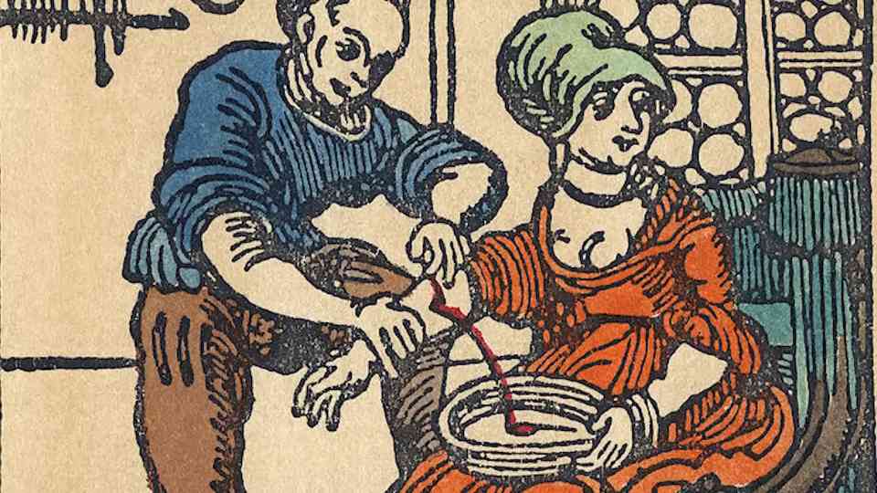 The most horrifying diseases of the Middle Ages