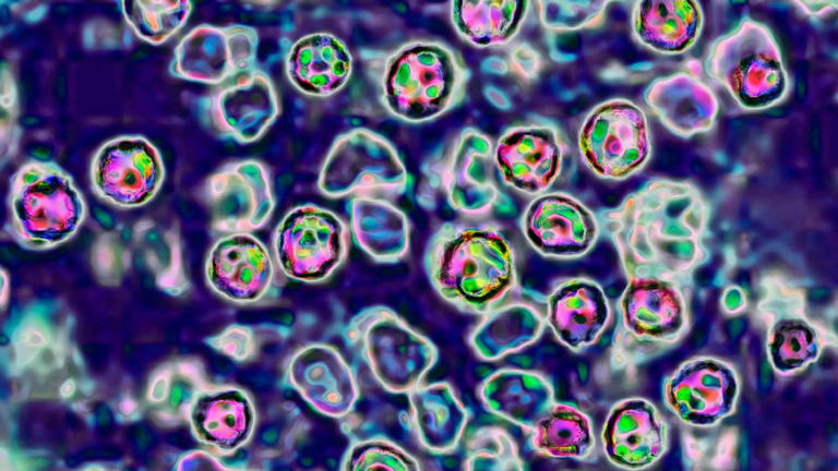Virginia measles outbreak: 10 new cases in Buckingham County confirmed