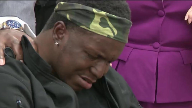Former Fulton County Jail inmate loses legs, fingers after alleged neglect