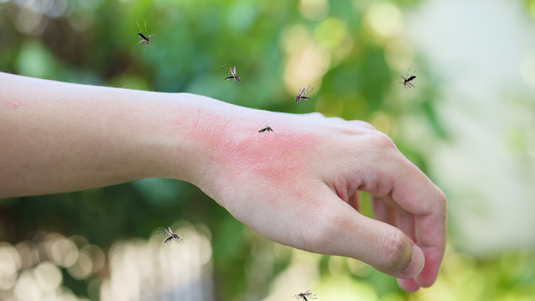 World Malaria Day 2026: From fever to chills: Early warning signs you ...