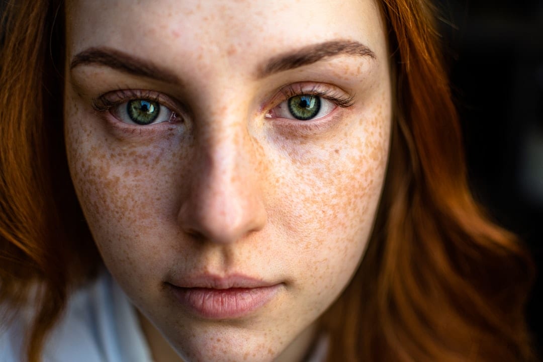 Nutritionist reveals 10 surprising signs of vitamin B12 deficiency you ...