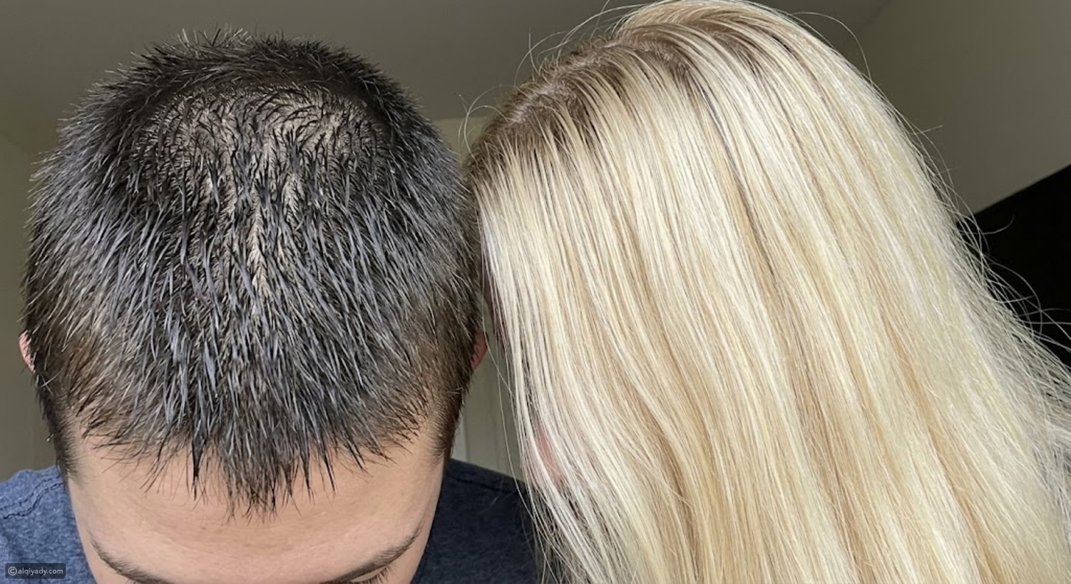 How often should you wash your hair? Dermatologists answer