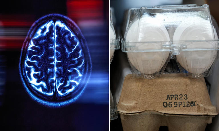 Scientists say eating eggs just twice a week cuts Alzheimer's risks by ...