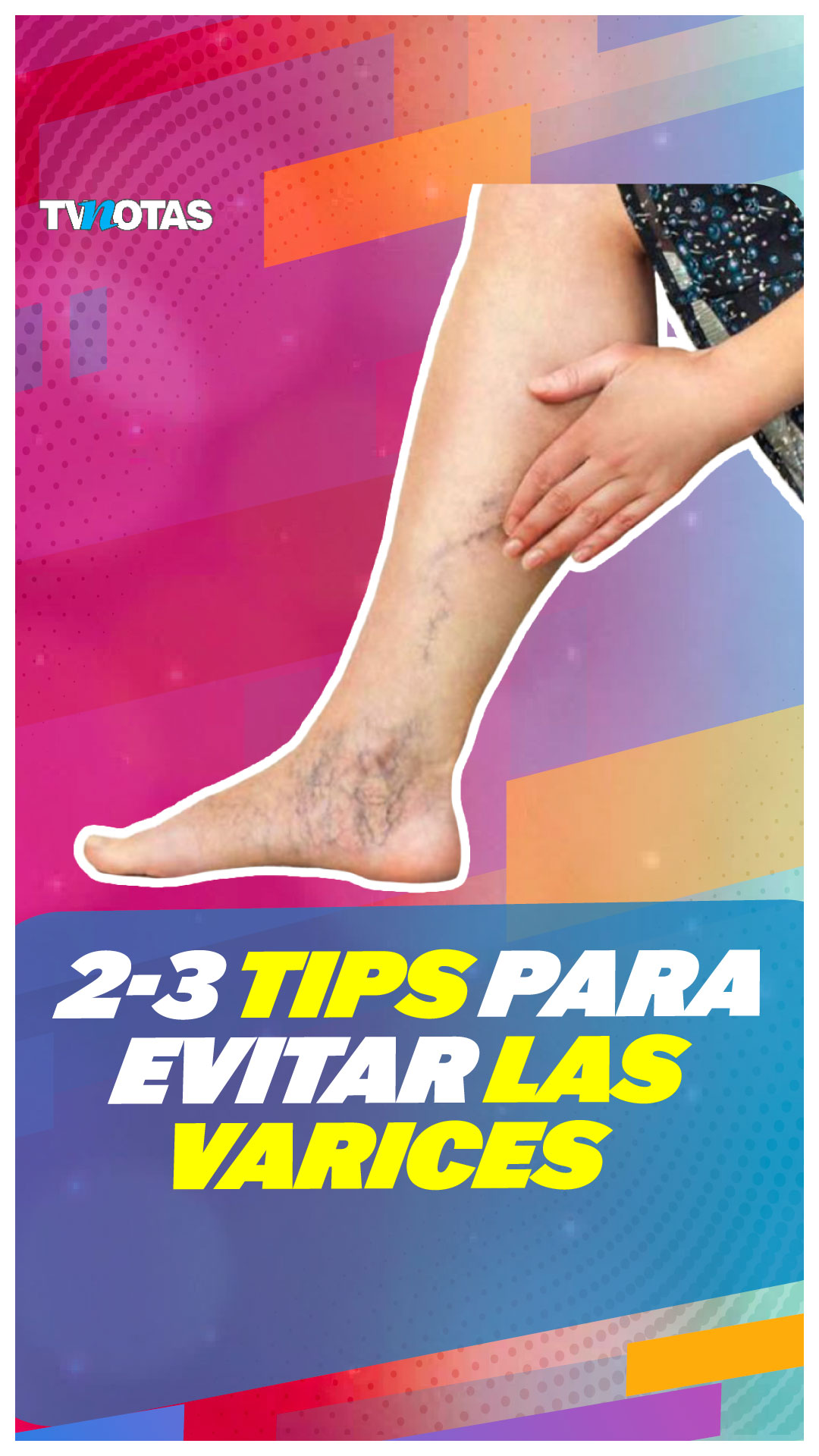 ¿Várices? Conoce los tips que pueden ayudarte con la prevención