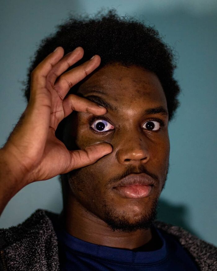 29 people share the rare genetic anomalies that make them unique