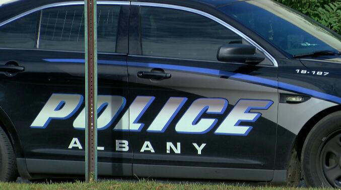 Woman accused of biting off another woman’s ear during fight in Albany