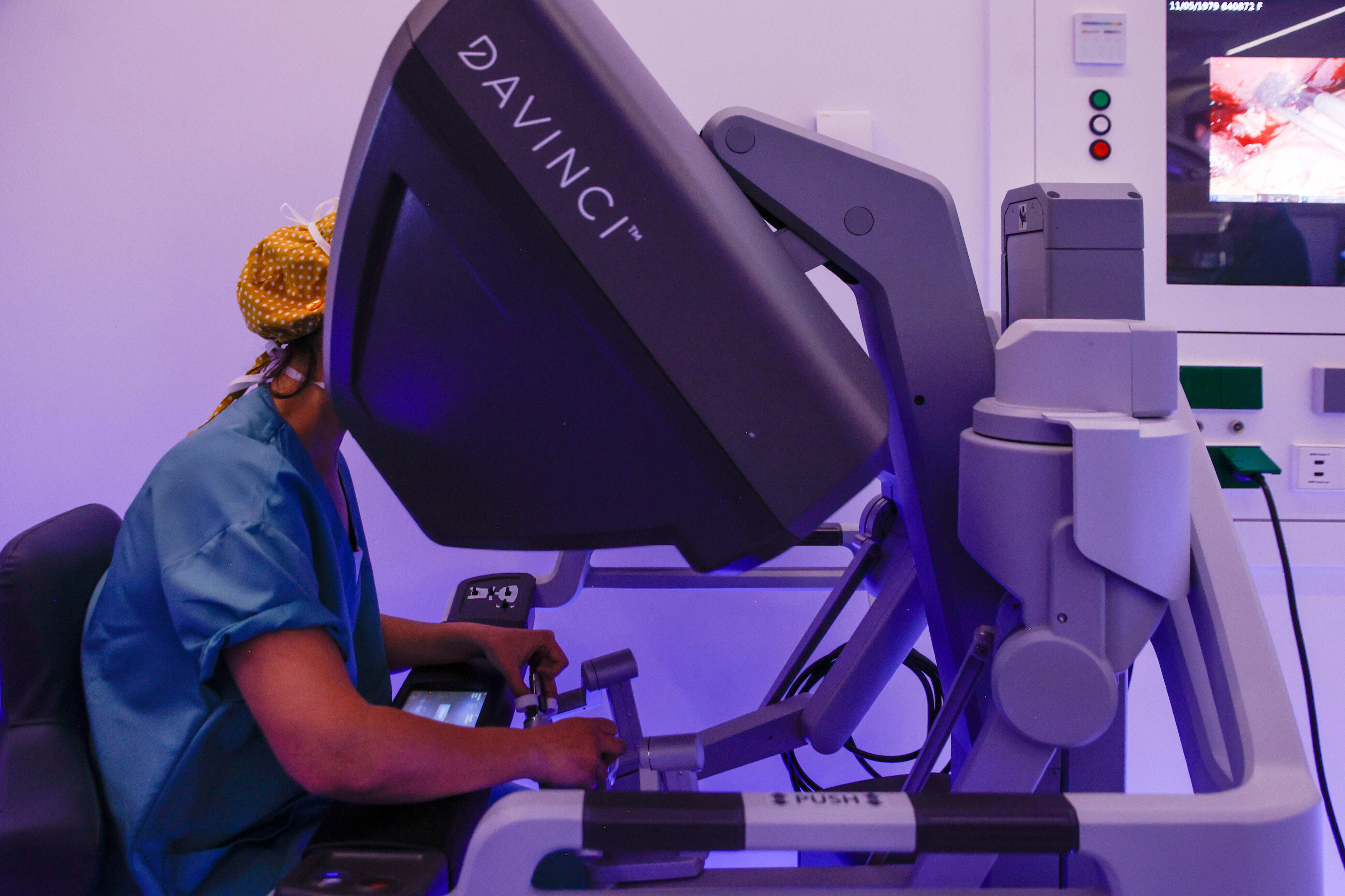 Robot in chirurgia, perché i medici bocciano le linee guida di Agenas