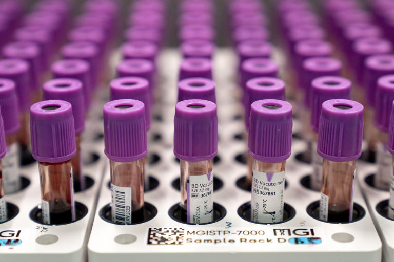 China races to build record biobank to rival US drugs research