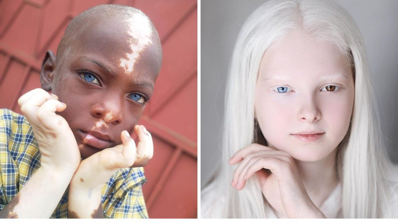 Photos that reveal the beauty of human genetics