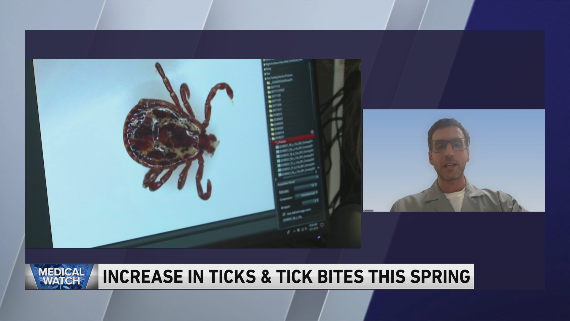 Take steps to prevent tick bites, CDC urges public as cases spike
