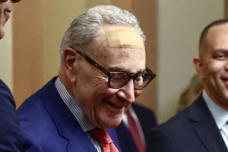 Chuck Schumer wore a giant bandage on his forehead for King Charles III ...
