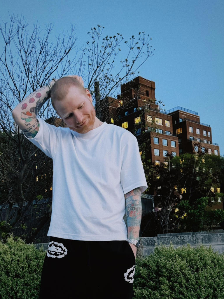 Ed Sheeran Debuts Shocking New Shaved Head Look A Fresh Start