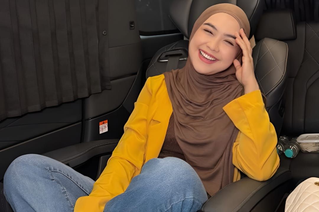 Penampilannya berubah, Ria Ricis beri klarifikasi soal operasi hidung ...