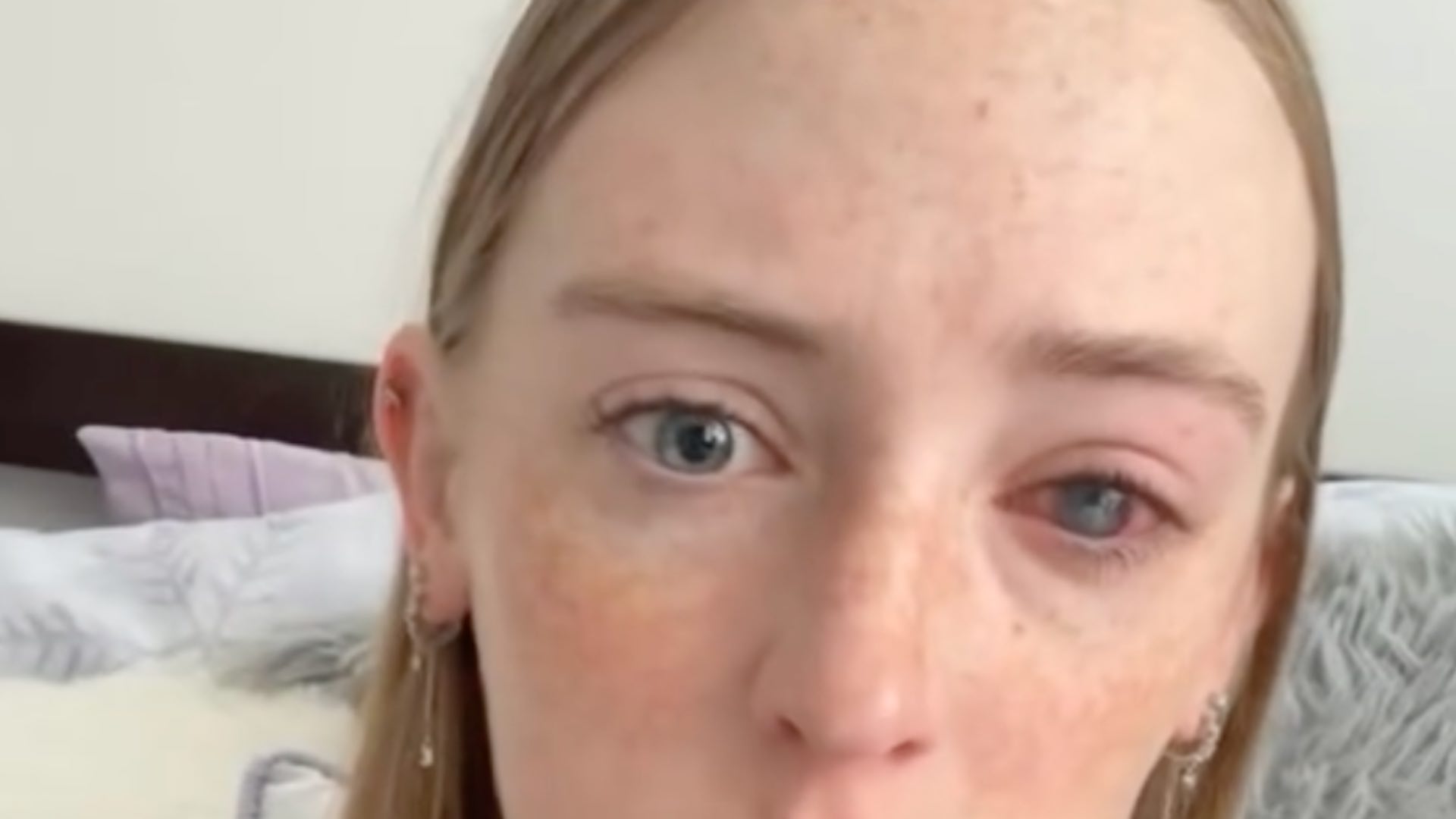 At 20 years old, this American tourist went blind in one eye after a ...
