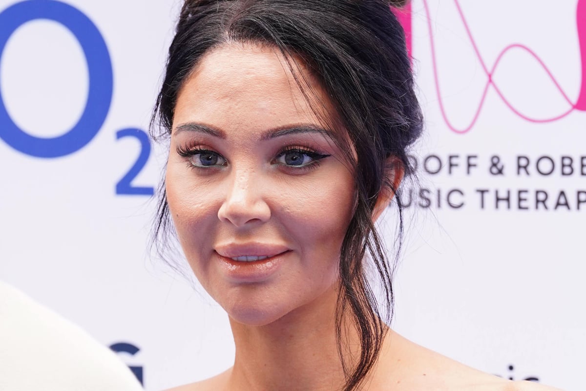 Tulisa reveals 'minor' but short-term paralysis after Bell's palsy attack
