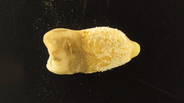 700-year-old mummy's tooth reveals ancient disease that killed thousands
