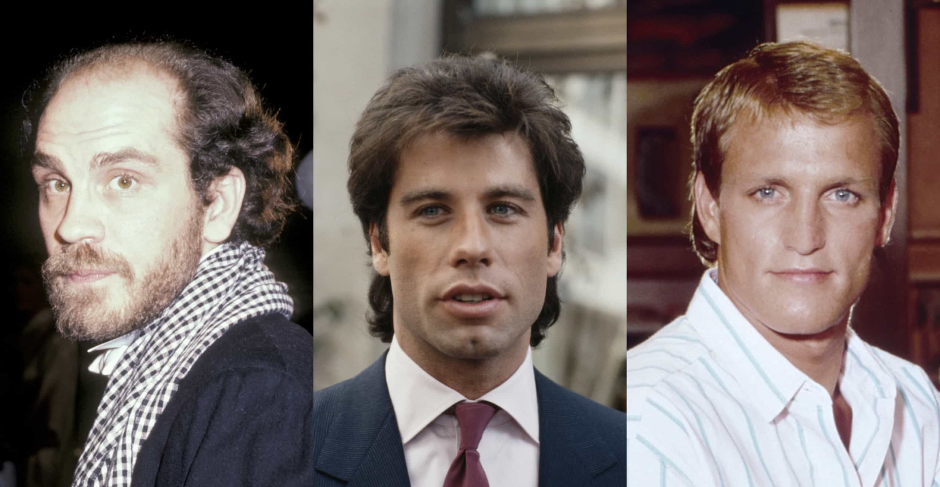 Bald celebrities when they had hair