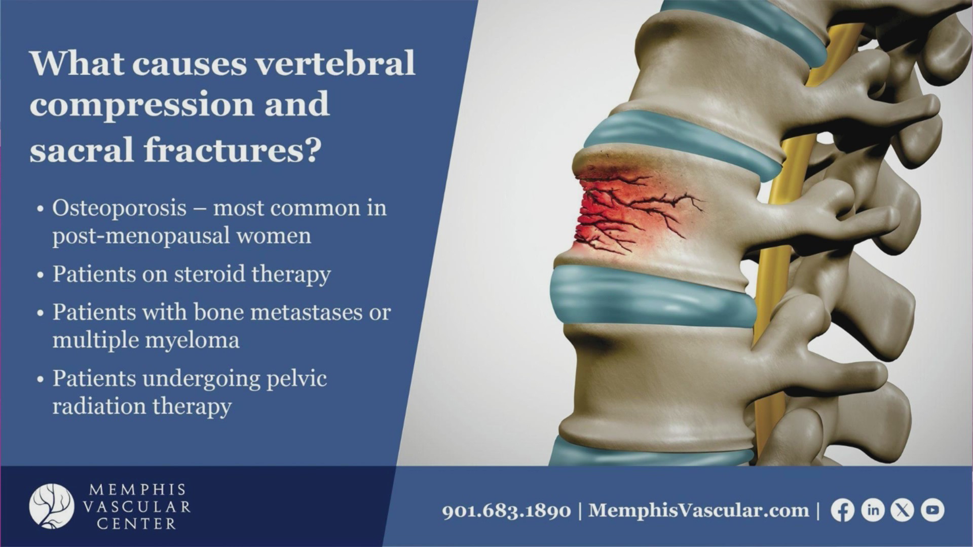 Minimally invasive treatment aids spinal compression fractures