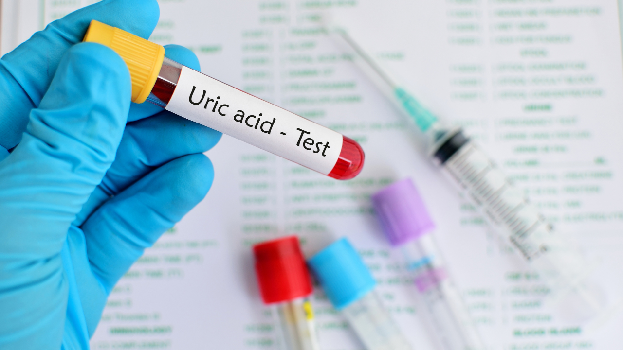 High uric acid but no symptoms? The silent kidney damage doctors say ...