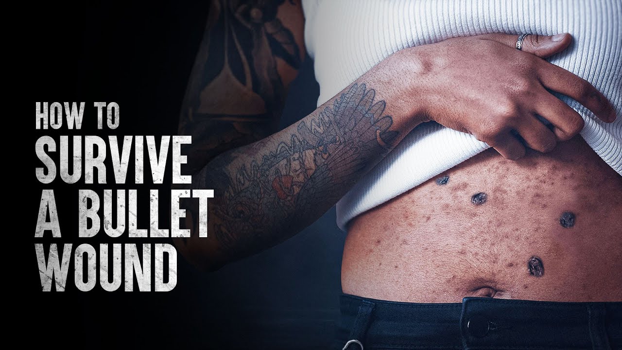 Learn the critical medical steps to survive a bullet wound