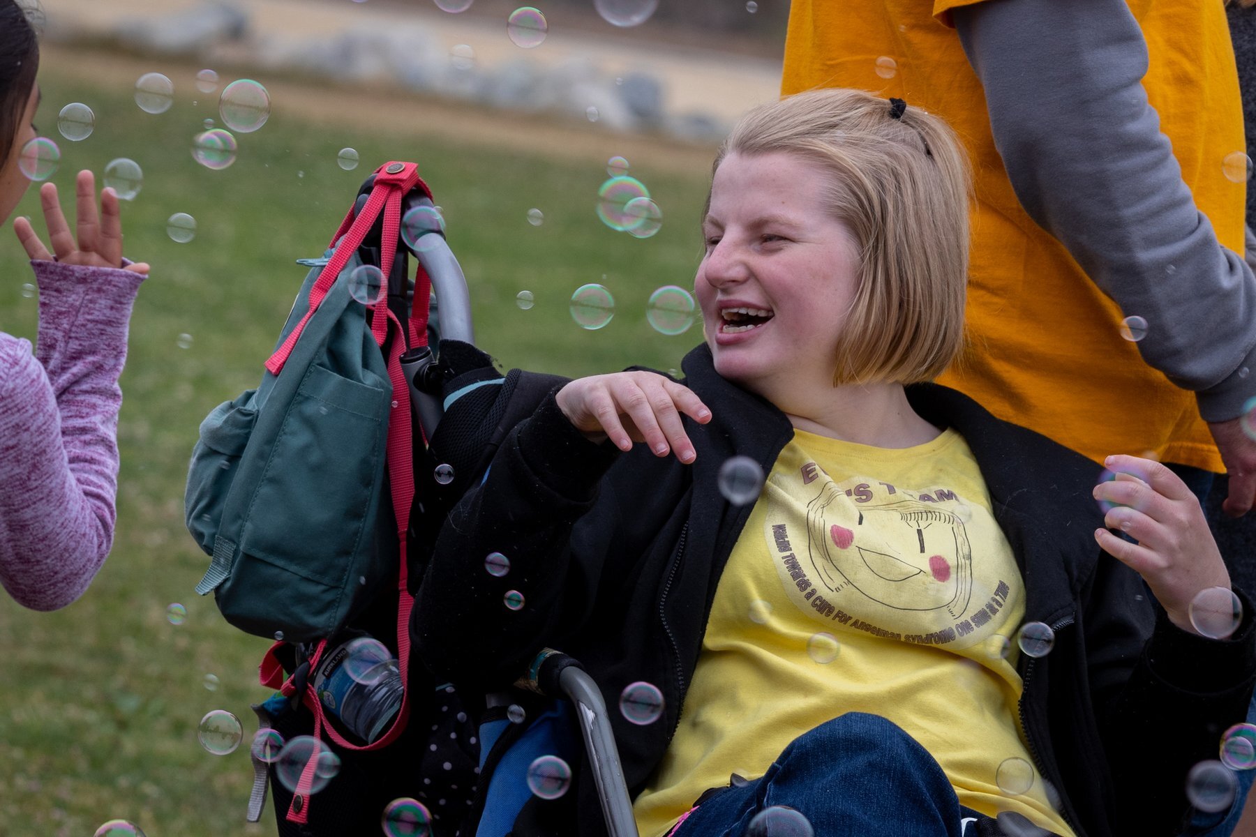 What is Angelman syndrome?