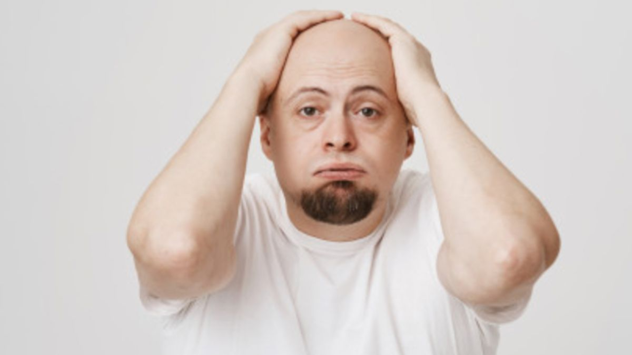 Alopecia areata myth: Does shaving your head really help hair regrowth?