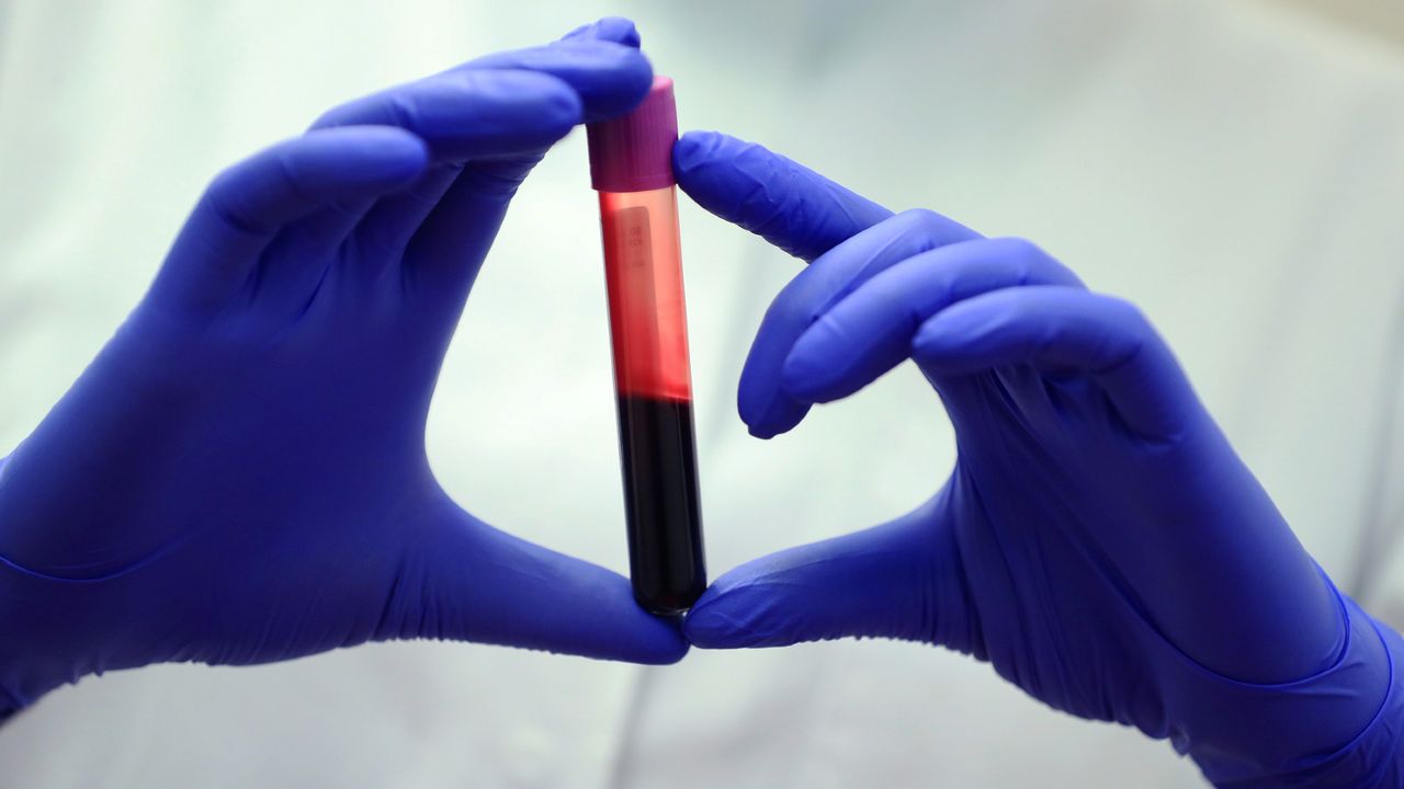 New blood test aims to spot liver scarring before it paves the way to ...