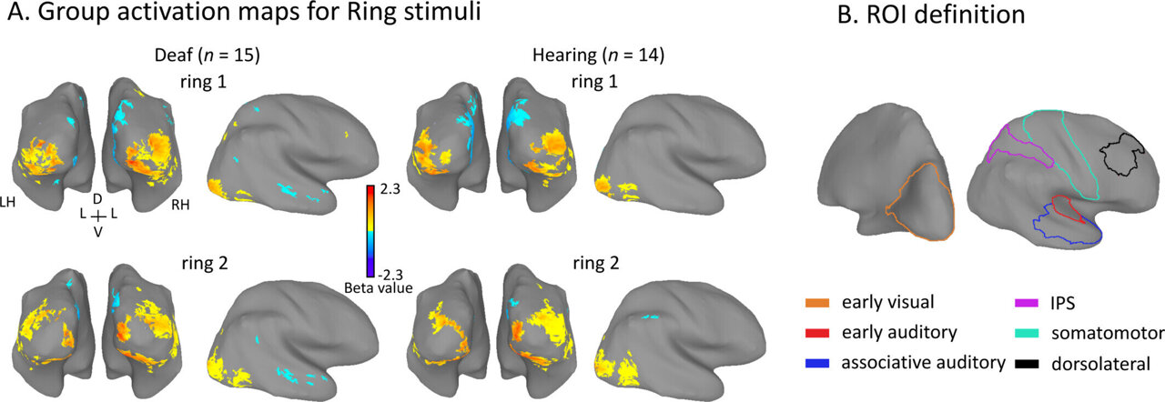 Can a deaf person's brain turn silence into vision?